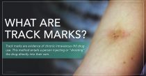 What Are Track Marks?
